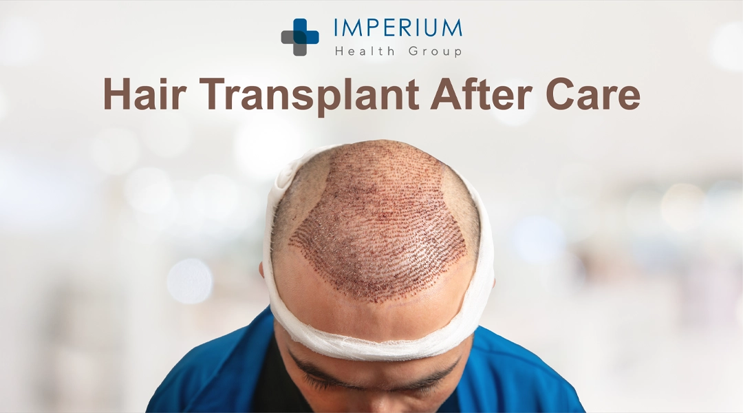Post Care After Hair Transplant: Essential Tips for Fast Healing ...